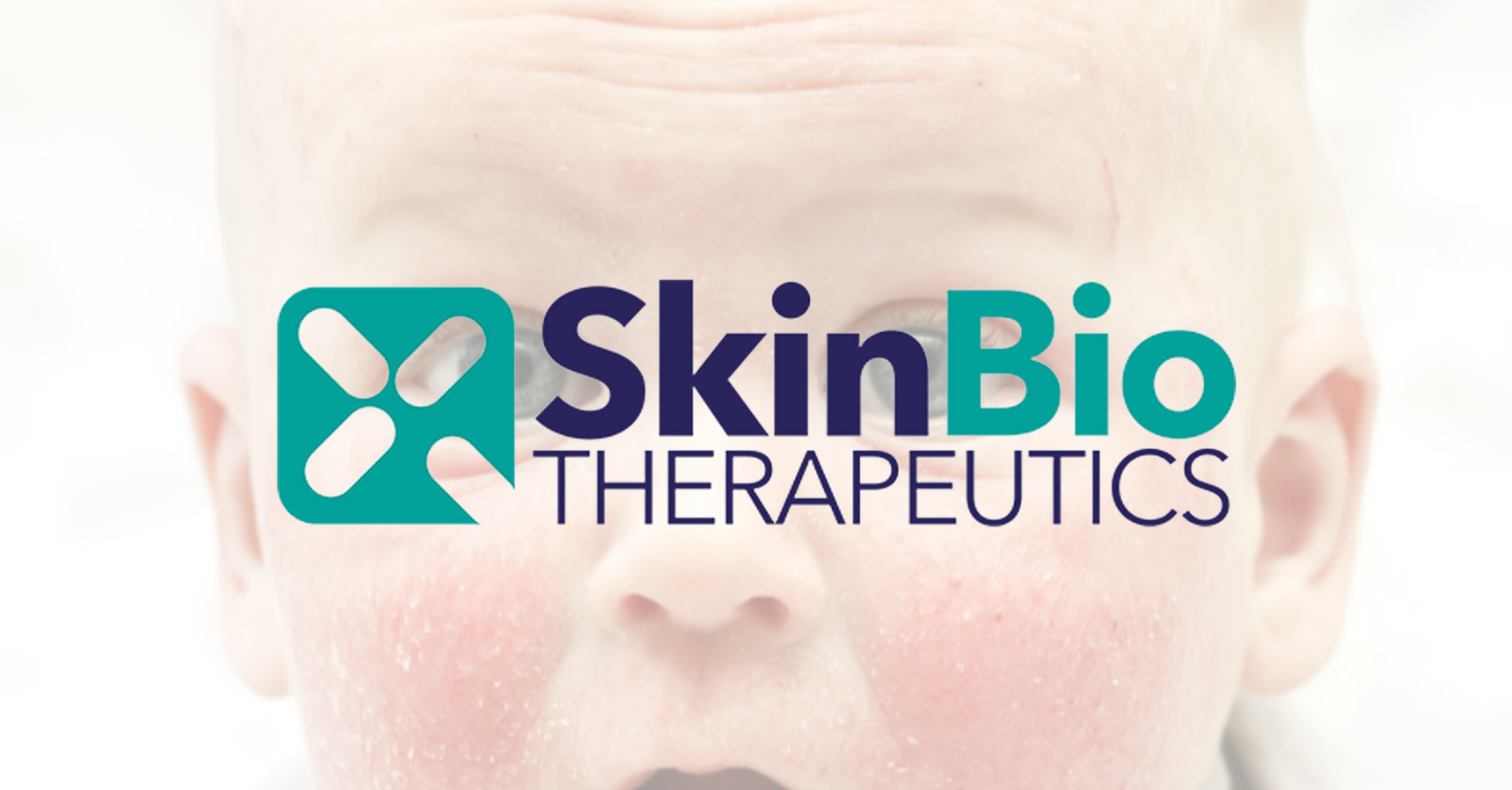 Investor Meet Company